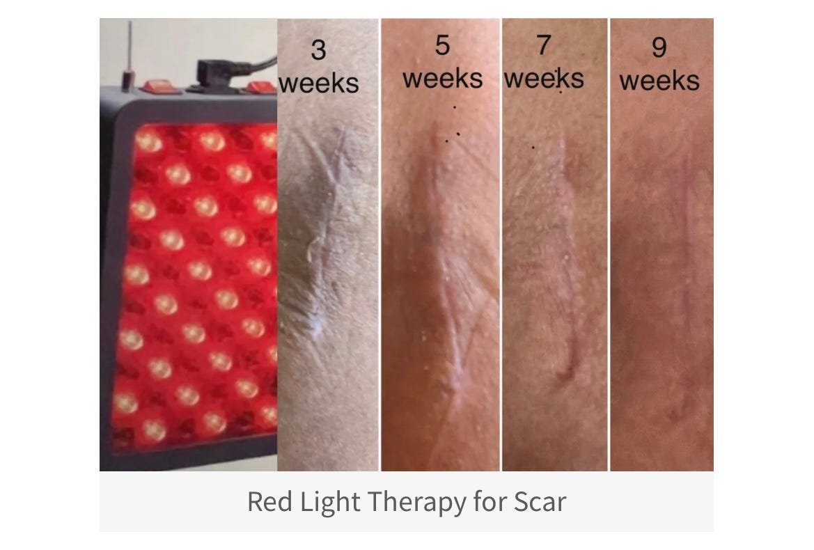 Red Light Therapy. Electromagnetic radiation includes a… | by ...