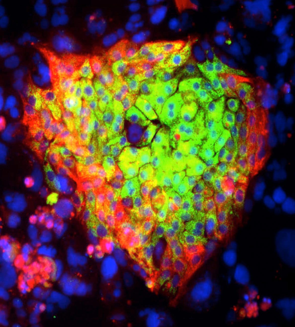 Liver Failing? Grow Some New Ones | by Brian Bergstein | proto.life ...