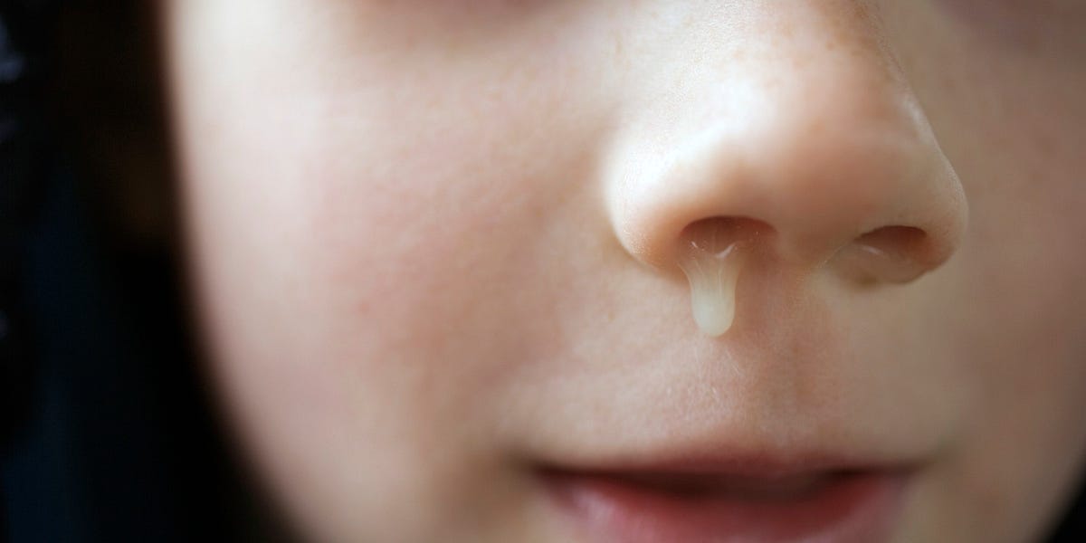 The Snotty Noes Kid That Never Quits | by HiJackJobs | Medium