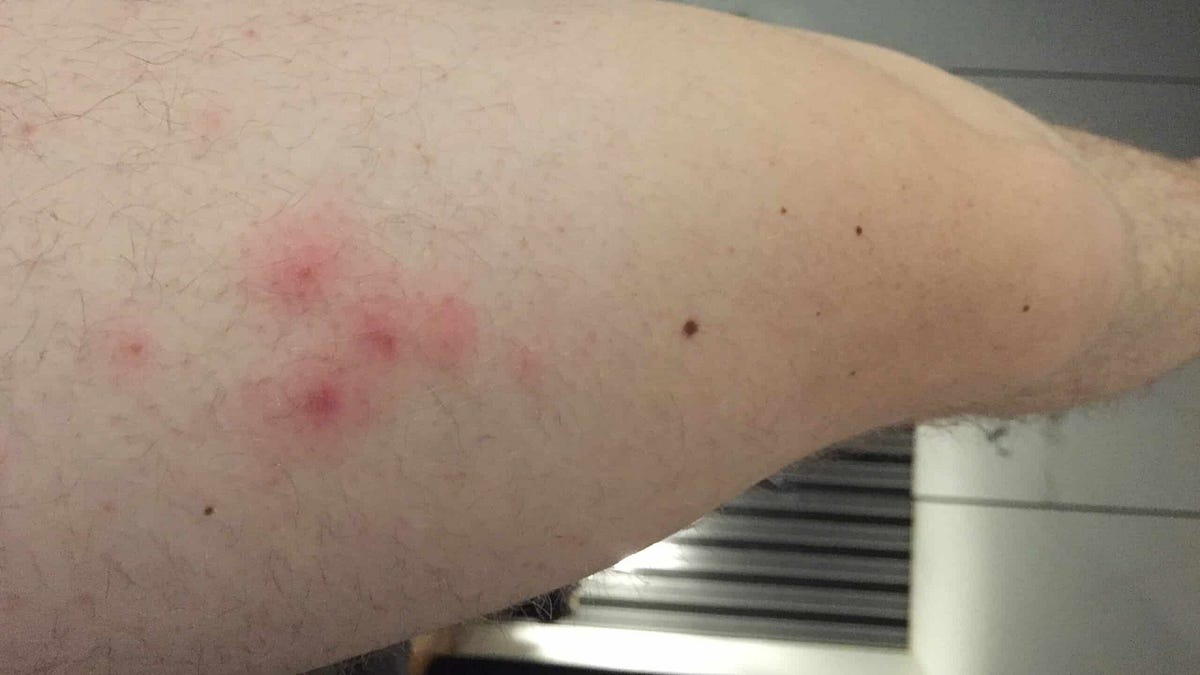 Learn to identify early signs of a bed bug infestation to prevent ...