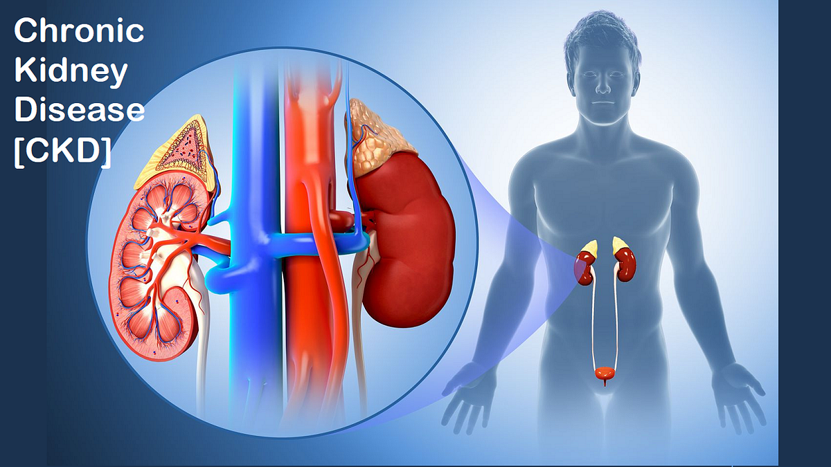 Chronic Kidney Disease [CKD] Progression | Best #1 | by Sevyam HIIMS ...