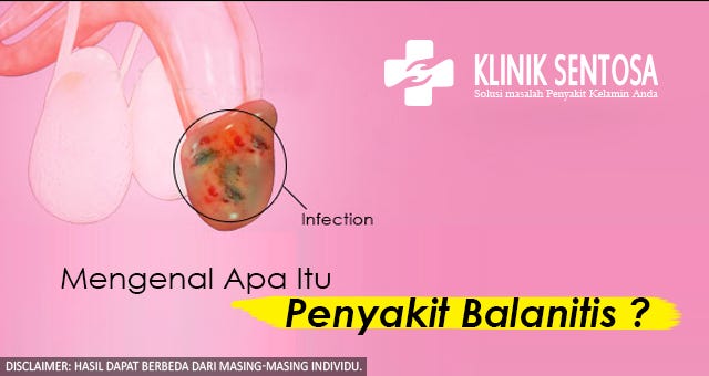 Penyakit Balanitis. Mengenal Apa Itu Penyakit Balanitis… | by Arnold ...