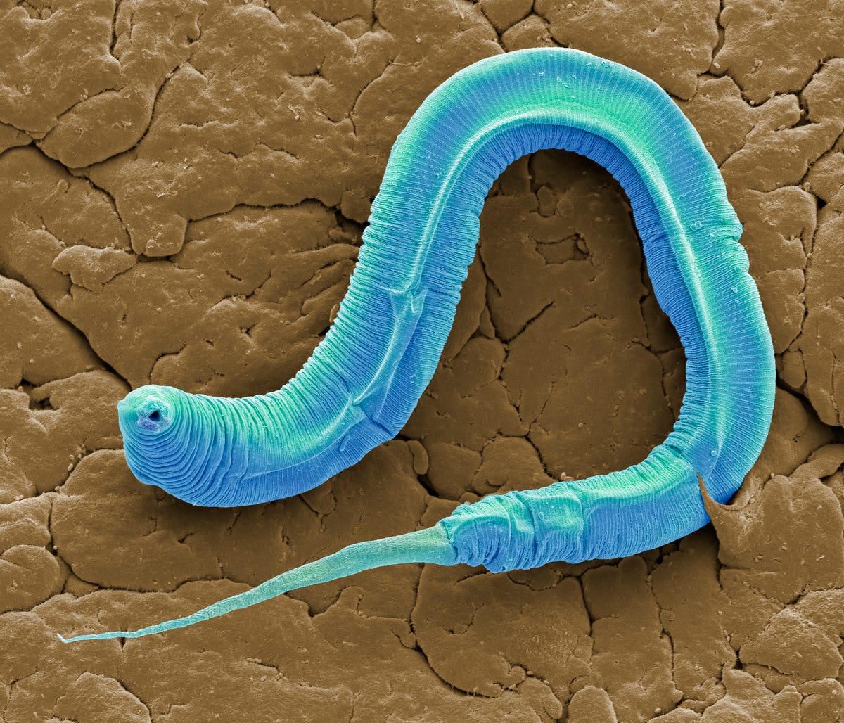 What Do These Worms and People Have in Common? | by Rich Sobel ...