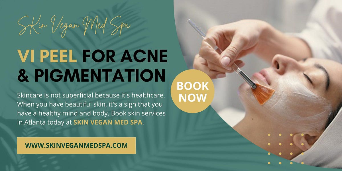 The Ultimate Guide to VI Peel for Acne and Pigmentation: What You Need ...