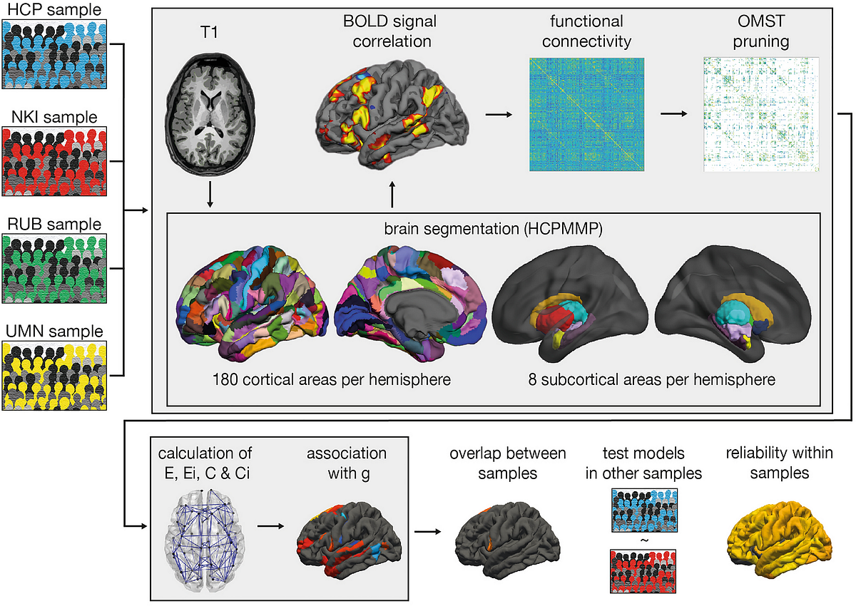Advancing Brain Connectivity Analysis with Cutting-Edge AI: A Deep Dive ...