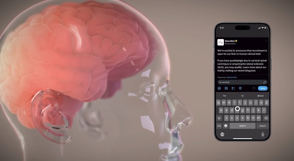 Mind Over Machine: Neuralink’s Breakthrough in Thought-Reading Implants ...