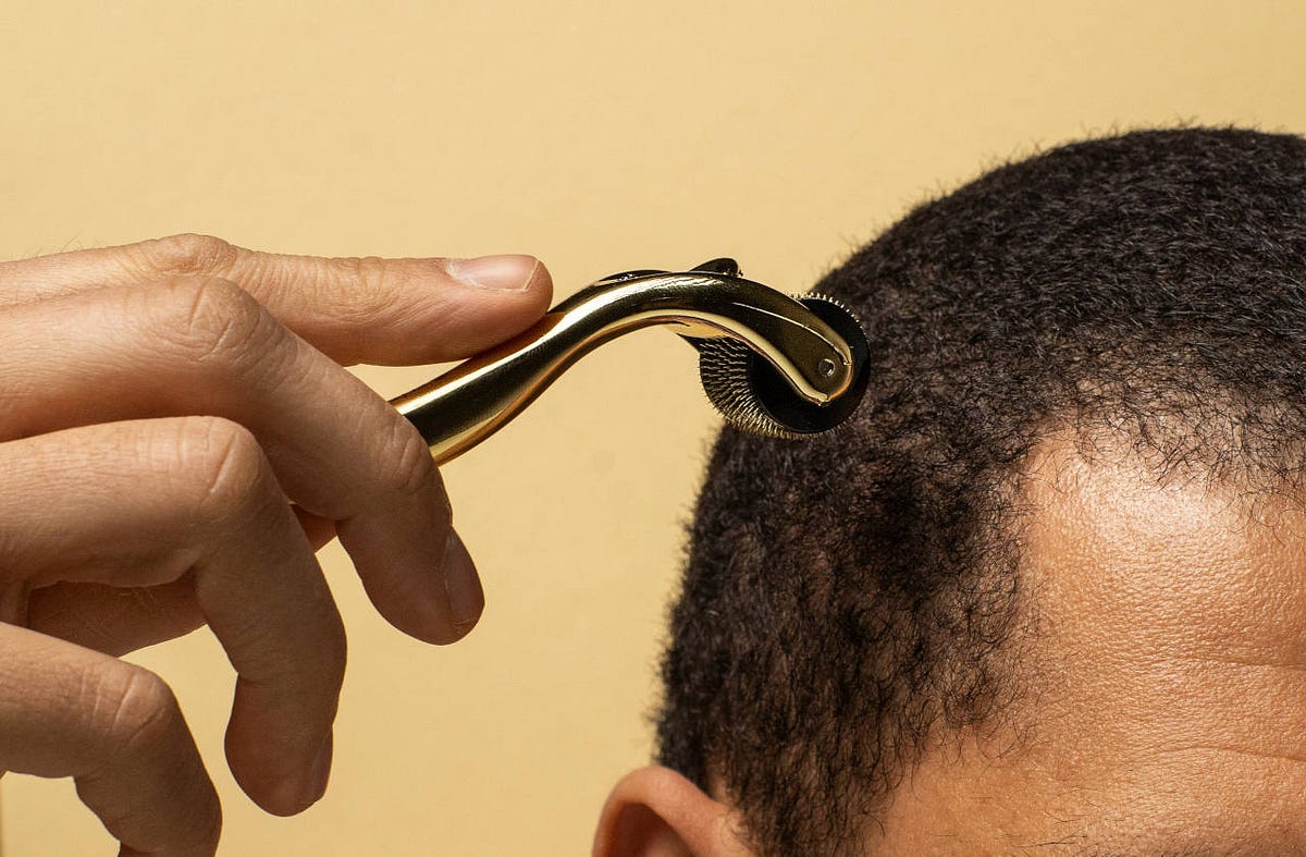 Mesotherapy hair: Is it effective for hair regrowth? Elithair | by ...