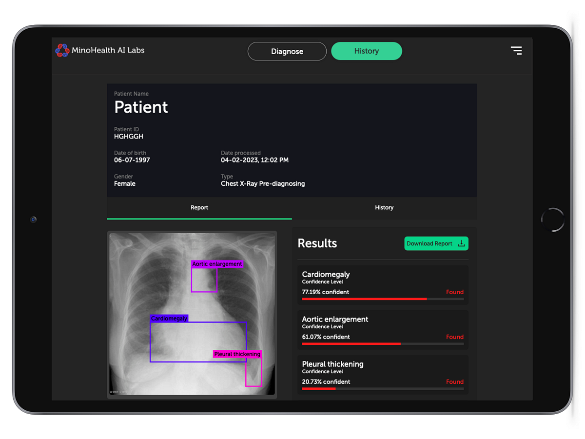 minoHealth.ai version 1.4.1: Launching AI for Chest Pre-Diagnosis via X-Rays | by minoHealth AI ...