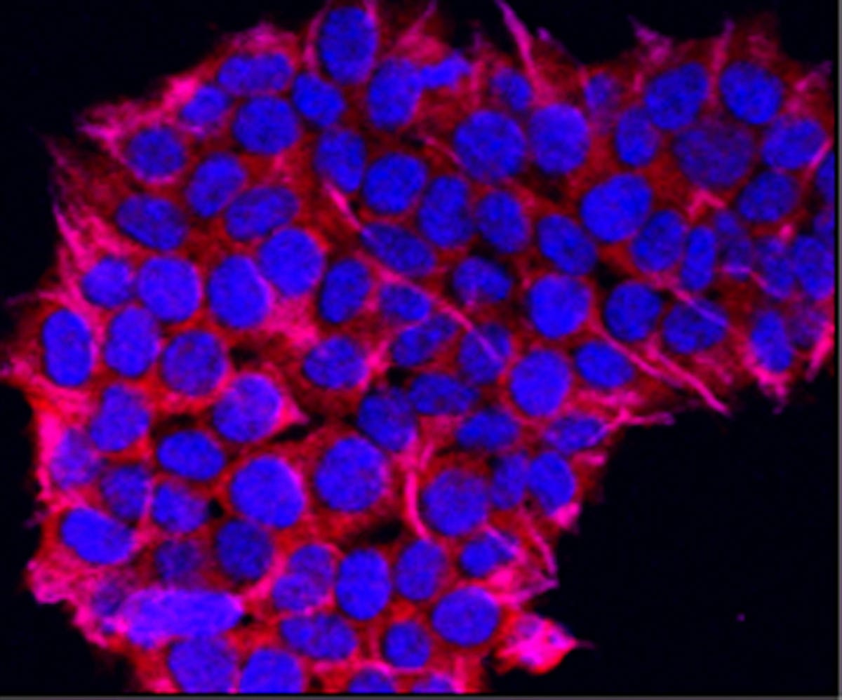 Artificial Intelligence to Diagnose Skin Cancer | by Michael Hunter, MD ...