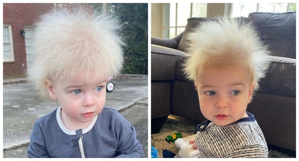 Uncombed Hair Syndrome: Everything You Need to Know | by Horoscope ...