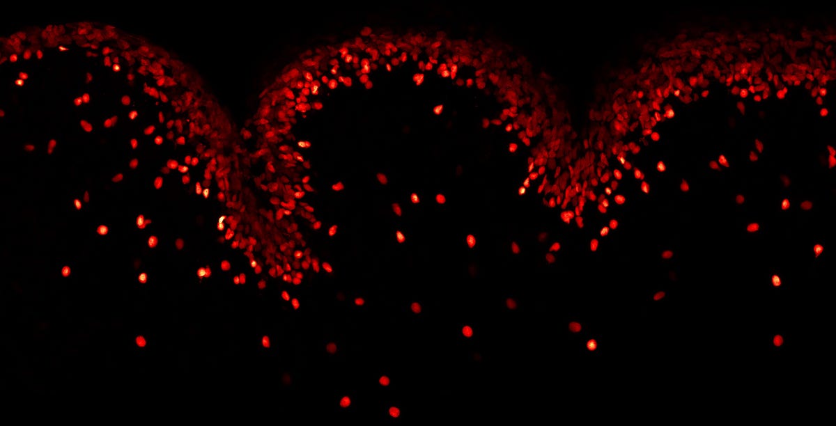 Folding the brain. 2D analysis shows how folding of the… | by eLife ...