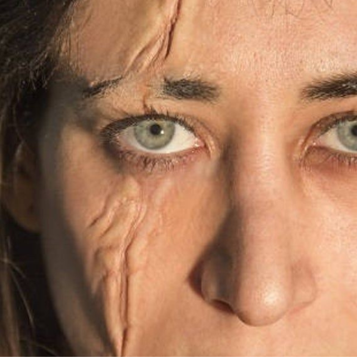 How to make scars heal faster on face | by Plotlinethe | Medium