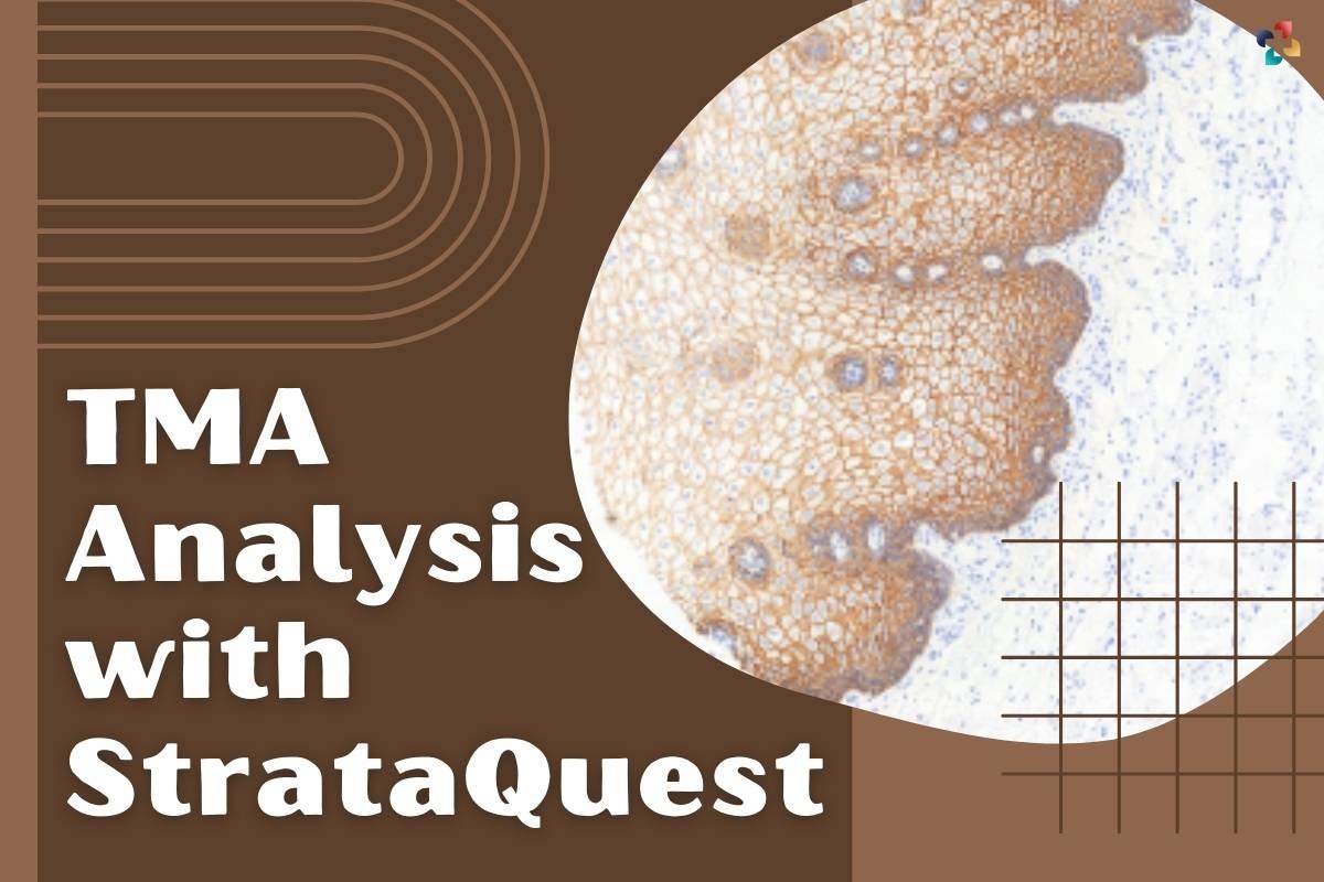 TMA Analysis with StrataQuest. Tissue microarrays (TMAs) have proven ...