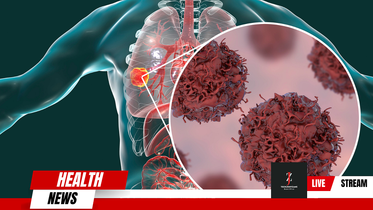 The Truth About White Lung Syndrome and its Potential Connection to a ...
