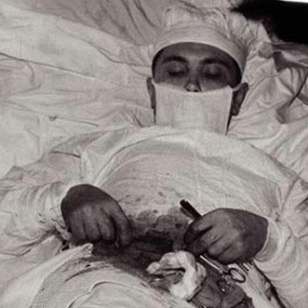 Dr. Leonid Rogozov operating himself to remove his appendix in ...