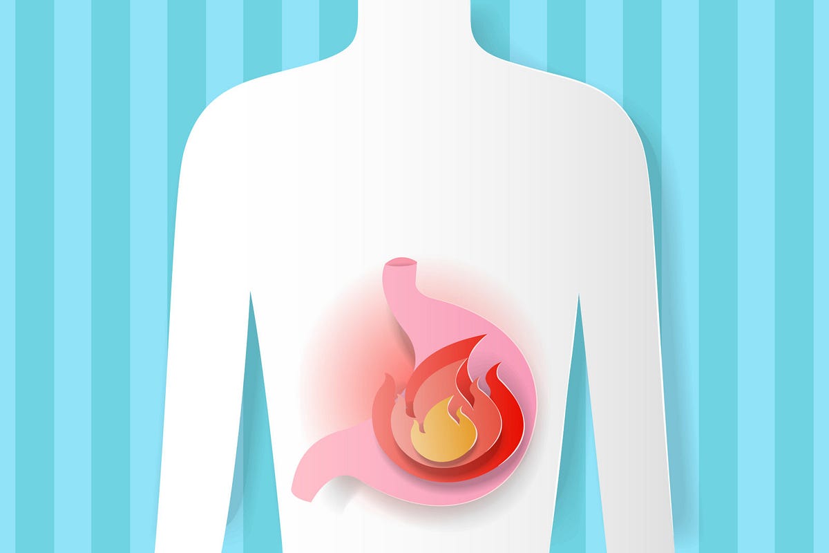 What is Heartburn And Why Does It Happen? | by Amanda Filipowicz | Medium