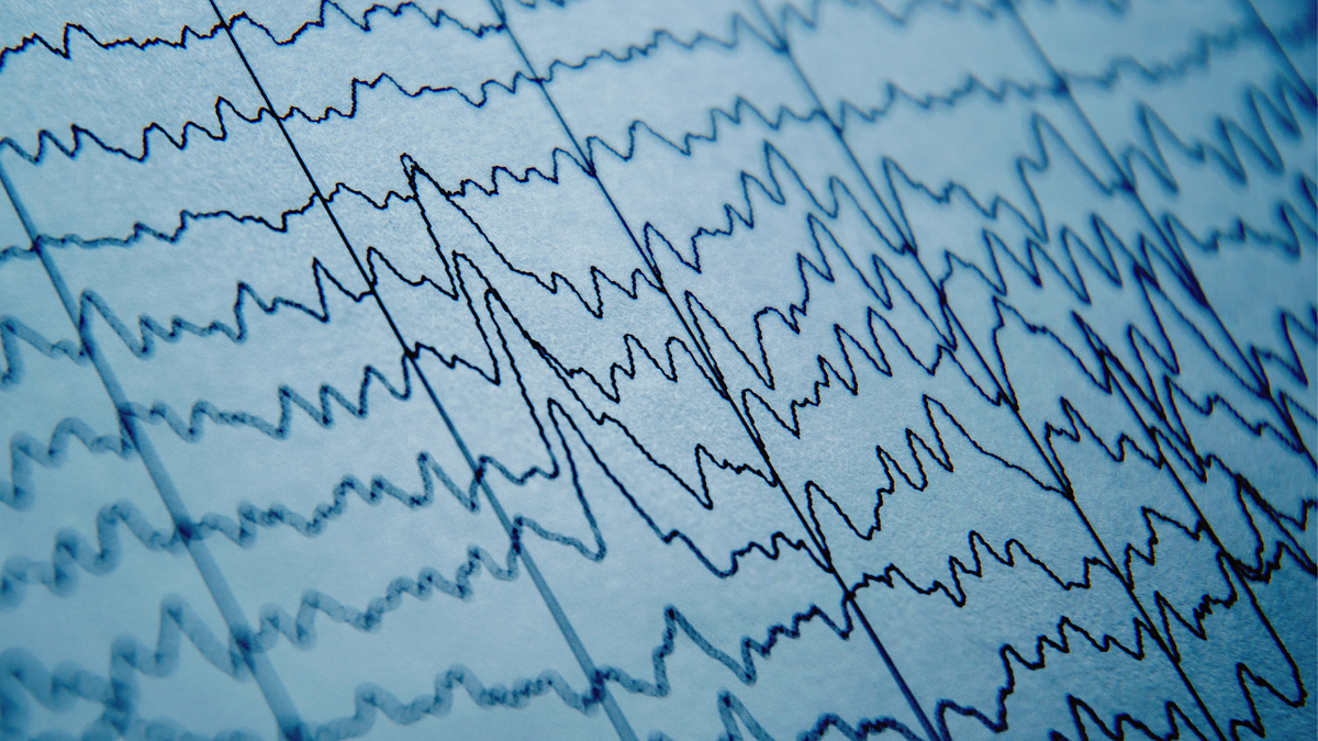 Deciphering the Brain Waves Chart: Understanding Your Mind’s ...