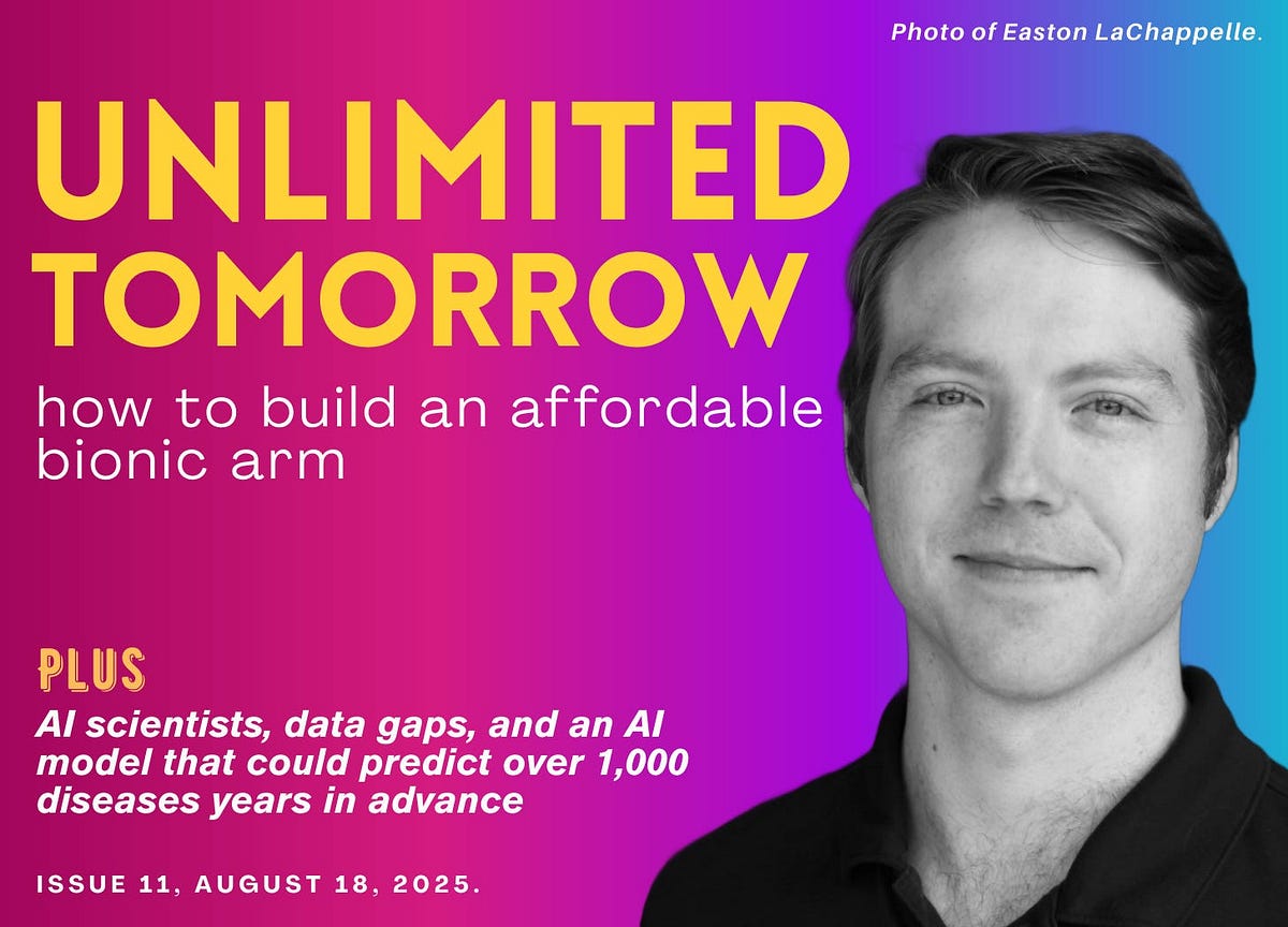 Unlimited Tomorrow: How To Build An Affordable Bionic Arm | by Sonia ...