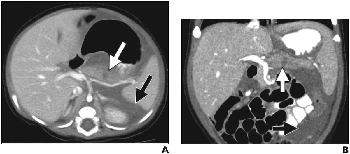 MRI For pediatric Pancreatitis — How to get Primary Consideration | by ...