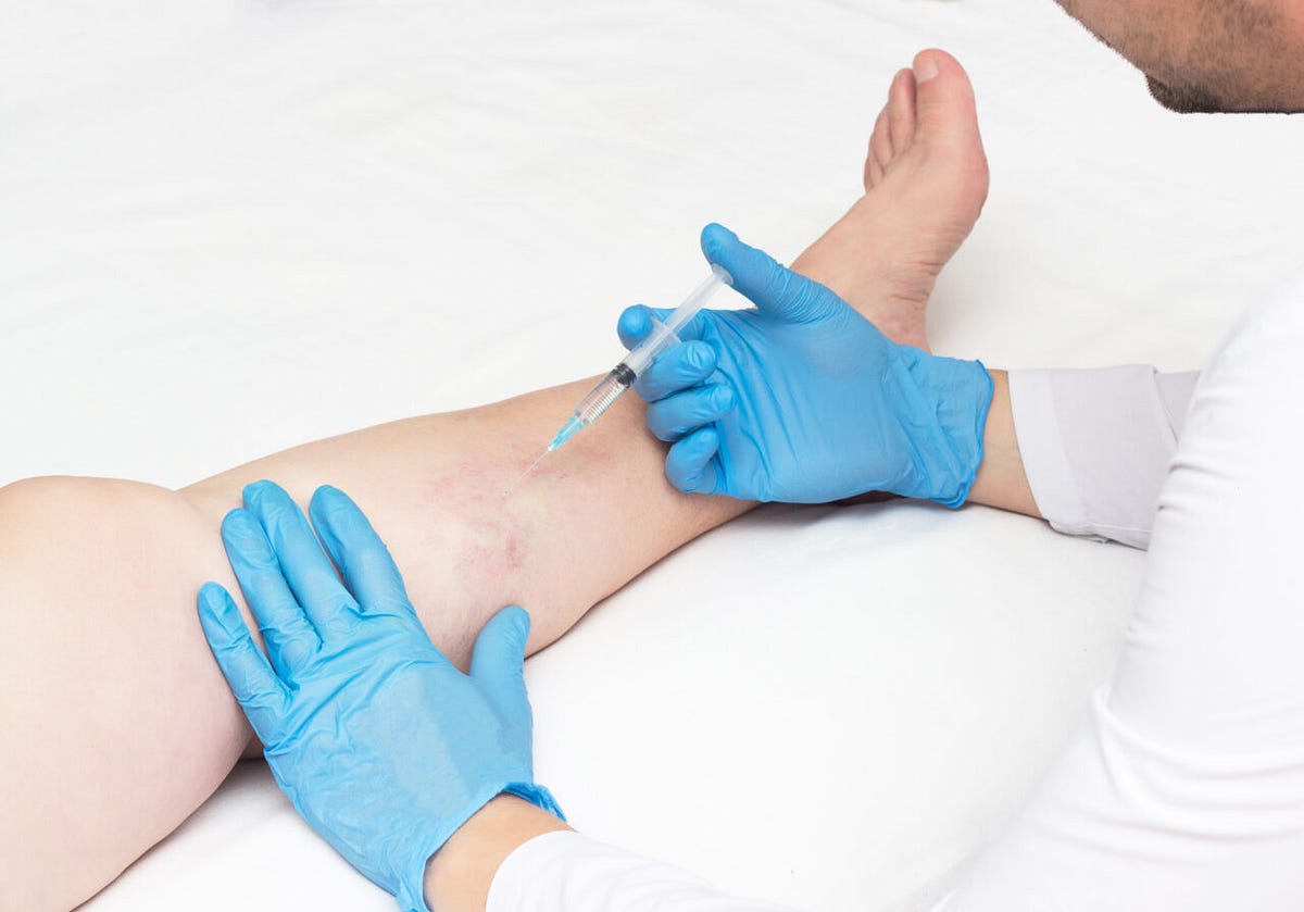 A Detailed Analysis of the Factors Affecting Vein Stripping Surgery ...