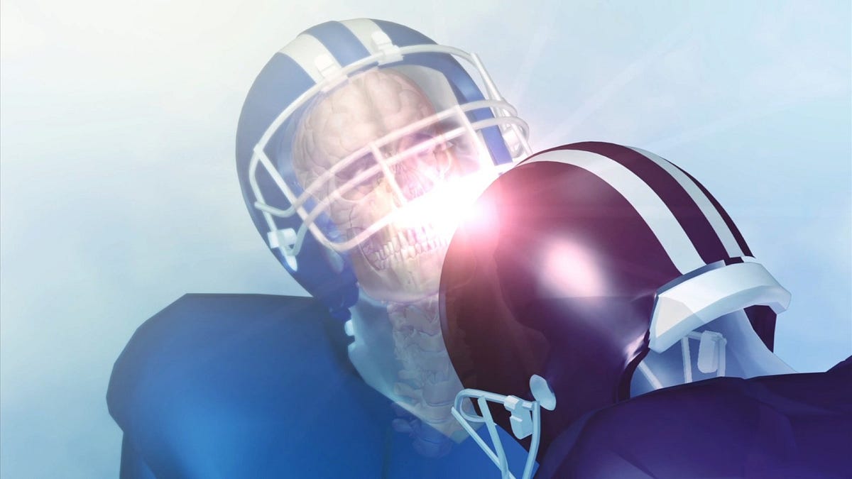 The Concussion Crisis in the NFL. Watching a big hit on the football ...