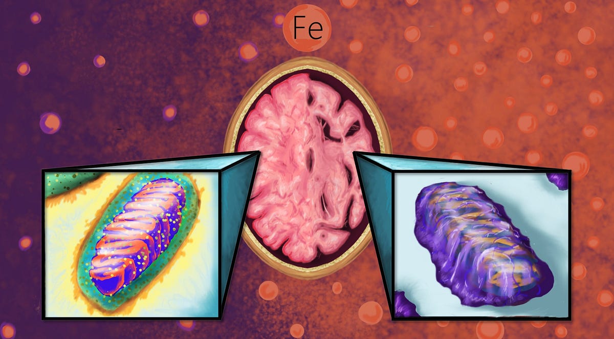 Iron overload | by eLife | Brains and Behaviour | Medium