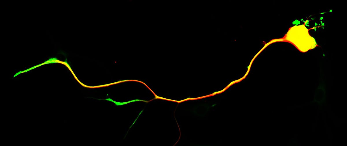 Regenerating neurons | by eLife | Brains and Behaviour | Medium
