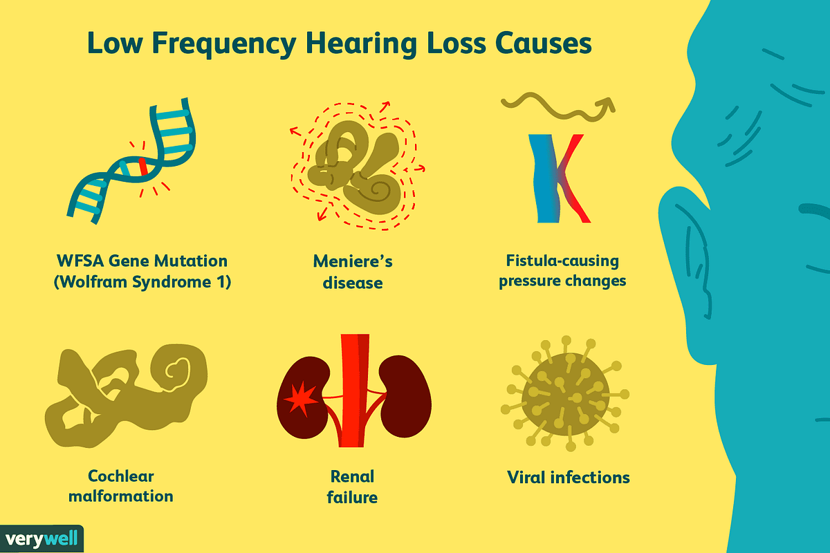 Sensorineural Hearing Loss Symptoms: Early Warning Signs to Watch | by ...