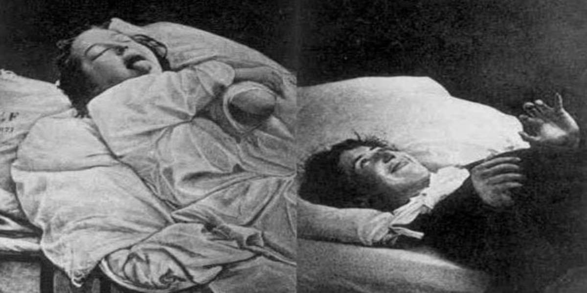 The Curious History of “Hysterical Paroxysm”: A Medical Practice of the ...