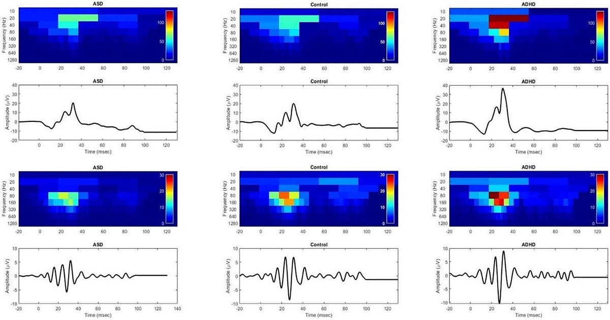 Unlocking Image Frequencies: The Role of Continuous Fourier Transform ...