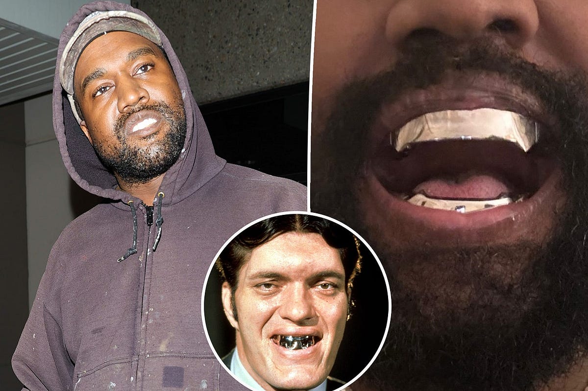 Kanye’s titanium teeth… is he going nuts or is he getting better? | by ...