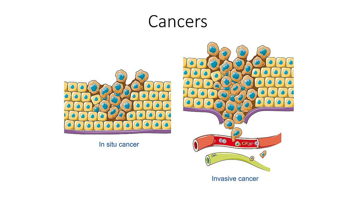 Issues with the genetic-mutation theory of cancer | ILLUMINATION