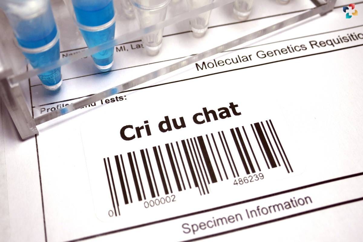 Understanding Cri du Chat Syndrome: Causes, Symptoms, and Management ...