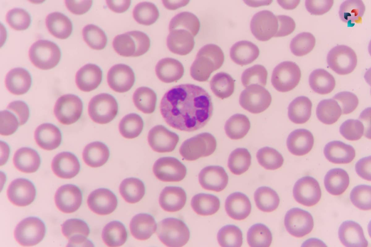 Understanding Absolute Neutrophil Count: Importance, Interpretation ...