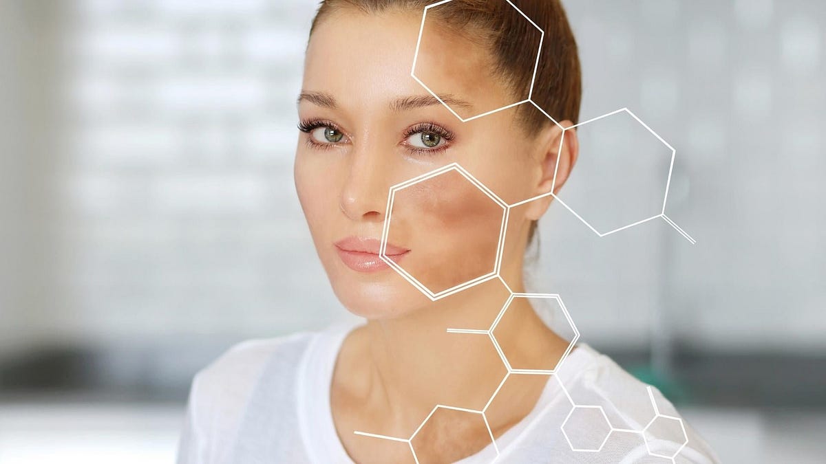 A Complete Guide to Hyperpigmentation and Melasma Treatments Near You ...