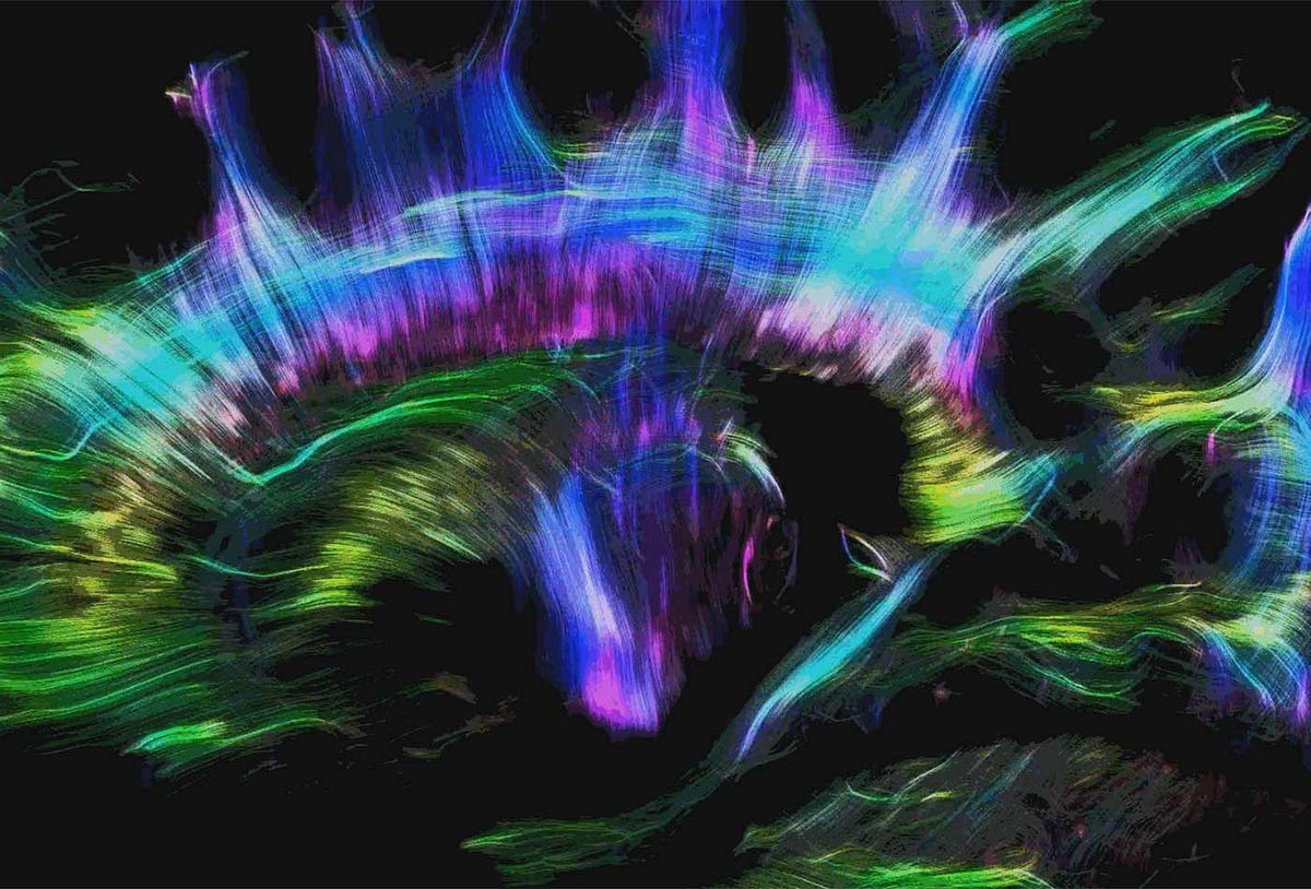 What the Bleep is Deep Learning?. Key Insight: | by George Laframboise ...