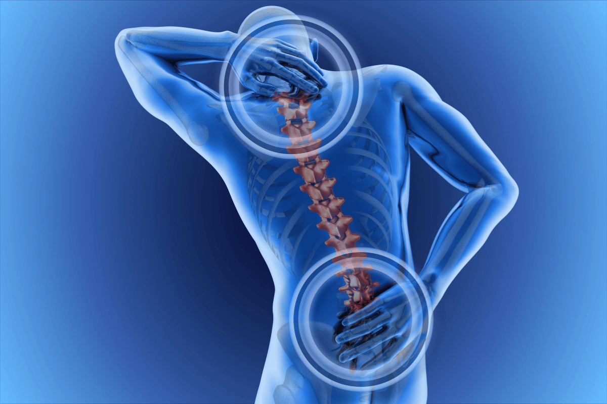 Exploring Disc Desiccation Causes Symptoms Treatments And Relief Thelondonwire Medium