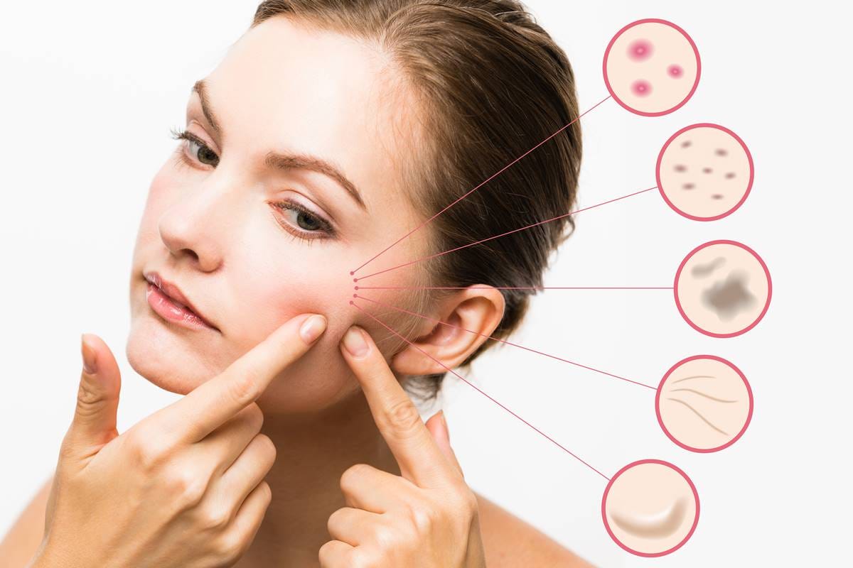 10 Effective Ways to Achieve Deep Acne Scar Removal with Laser Acne ...