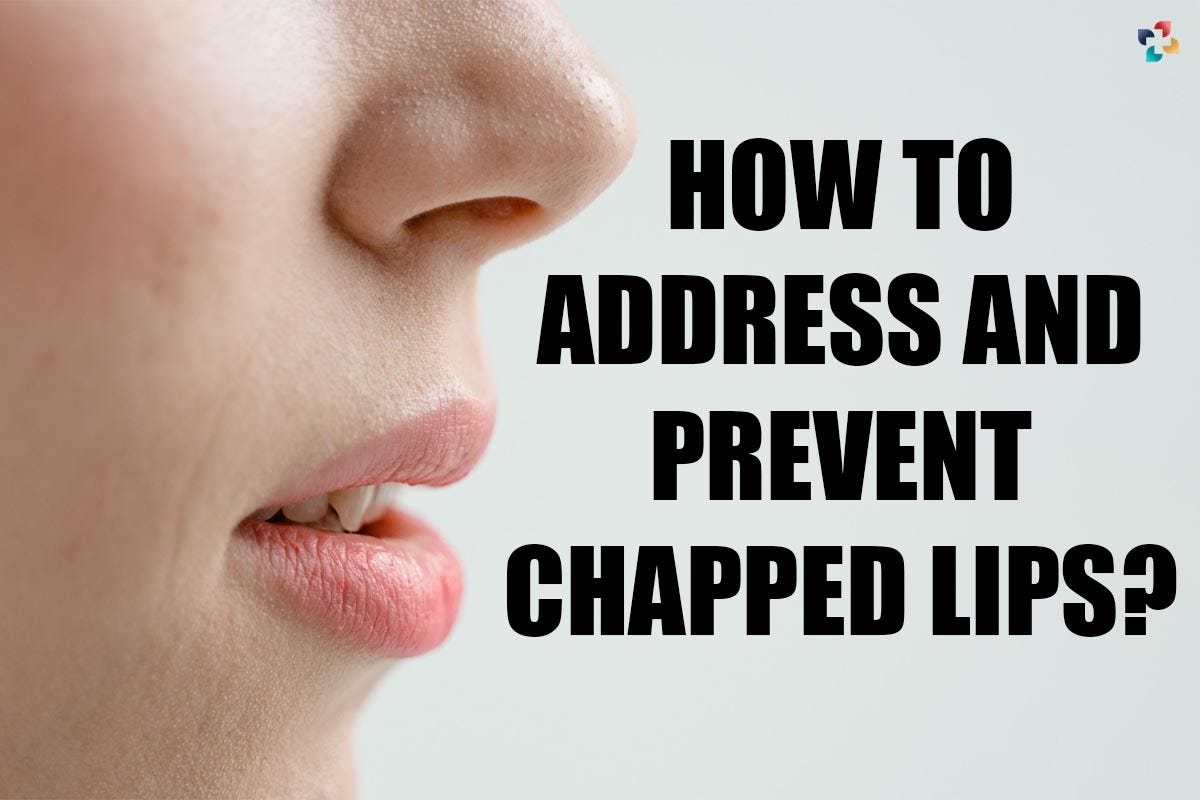 How to Address and Prevent Chapped Lips? | by Thelifesciencemagazine ...