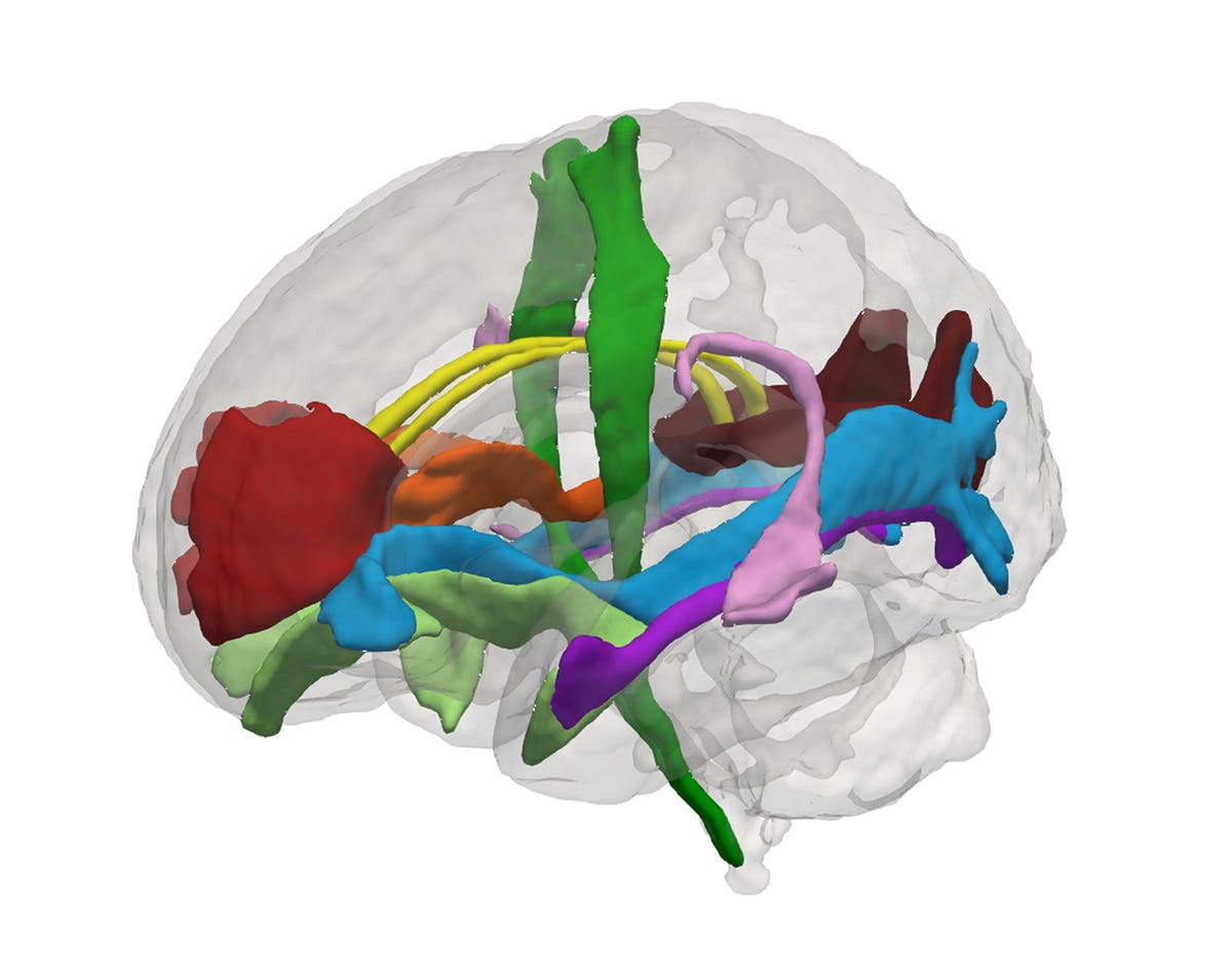 Brain under stress. Being exposed to high levels of the… | by eLife ...