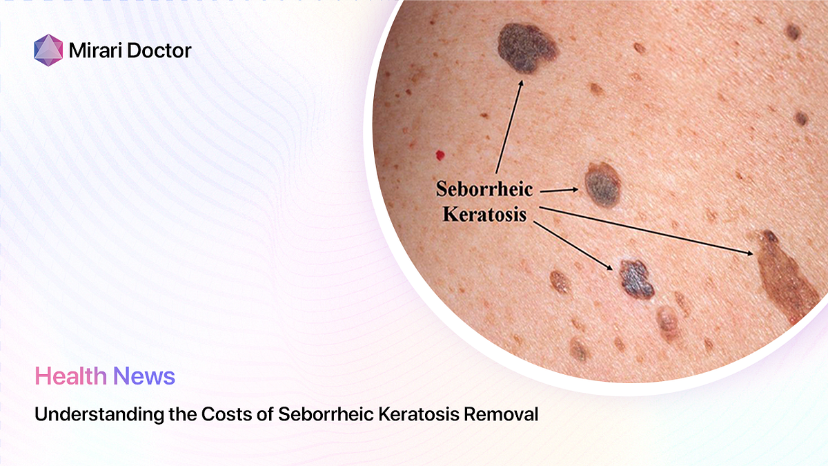 Understanding the Costs of Seborrheic Keratosis Removal | by Mirari Doctor | Medium