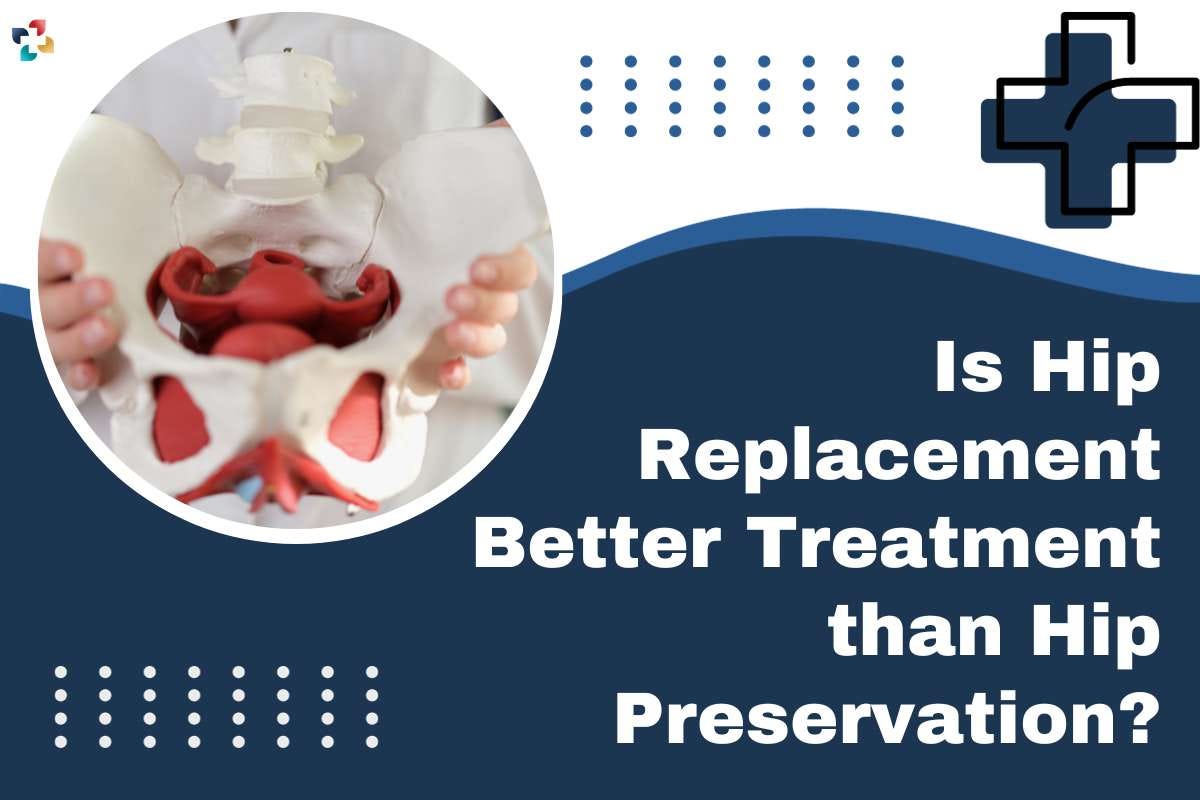 Is Hip Replacement Better Treatment than Hip Preservation? | by ...