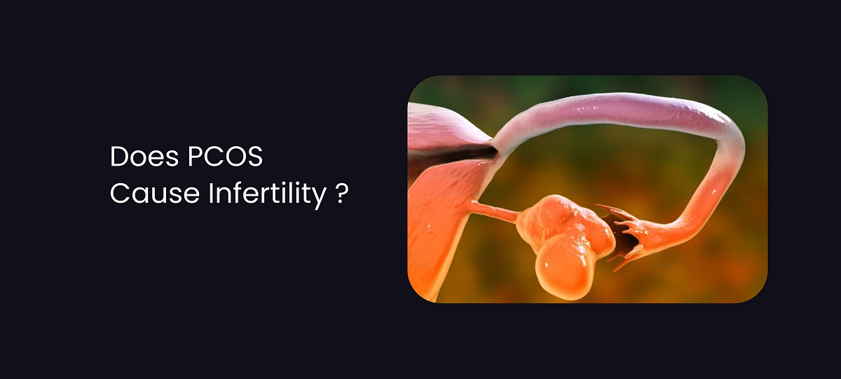 Does PCOS Cause Infertility?. What exactly is PCOS? | by Jayti Shah ...