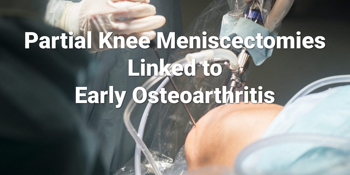 KNEE MENISCECTOMIES LINKED TO OSTEOARTHRITIS | by Virtual Physical ...