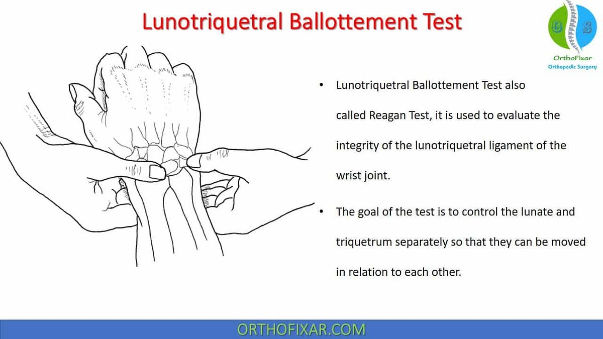 Lunate Triquetral Joint