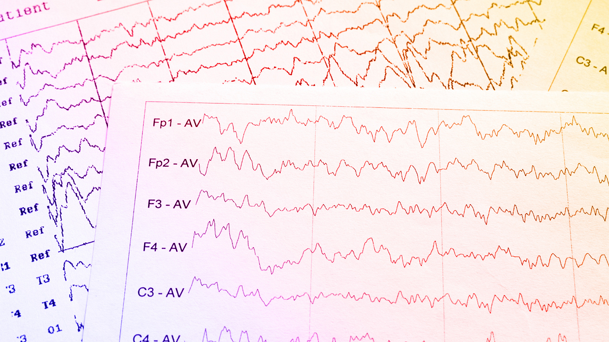 Understanding the Brain Wave Frequency Chart: A Guide to Cognitive ...