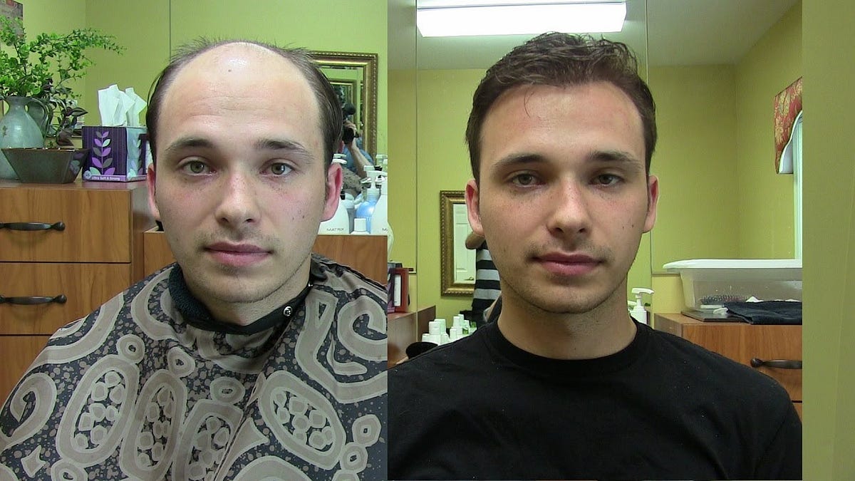 How to use toupee. Toupee is a hairpiece to cover up male… | by Hair ...