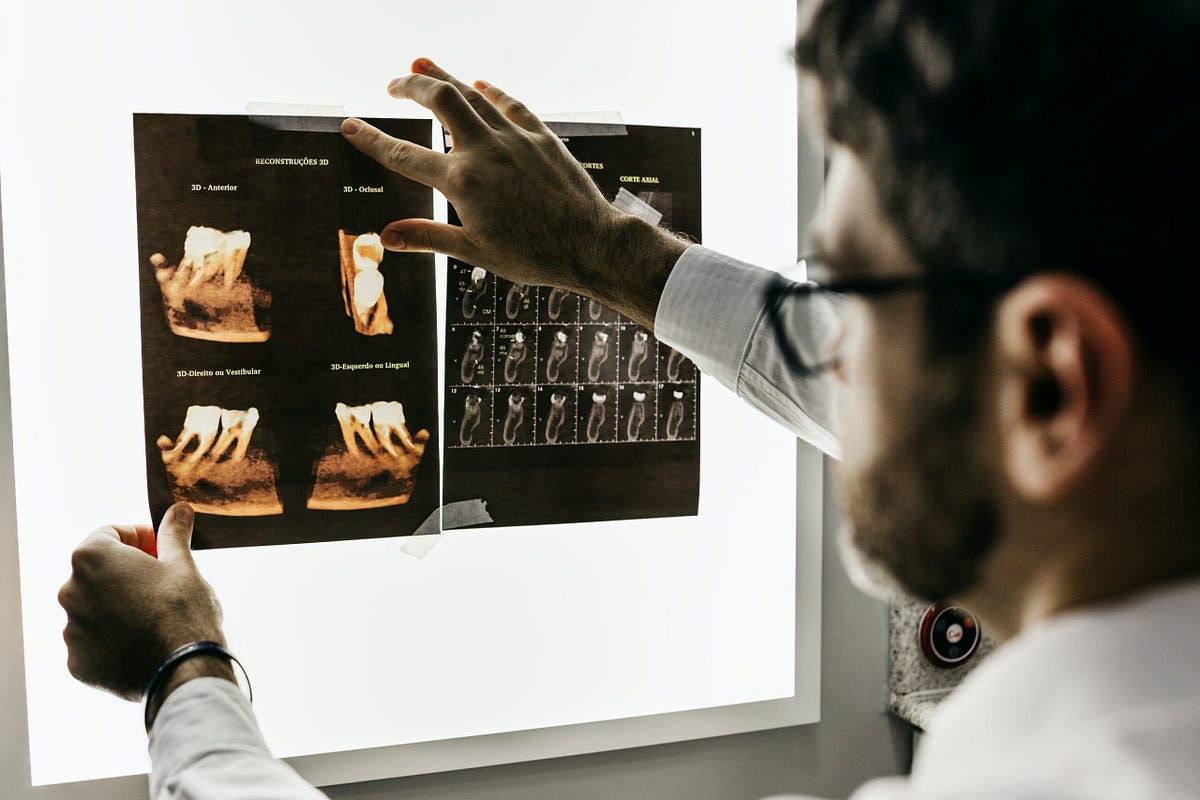 Osteonecrosis Of The Jaw: Clear Dental Guidelines (2023) | by Nickolas Steel | Founder at ...