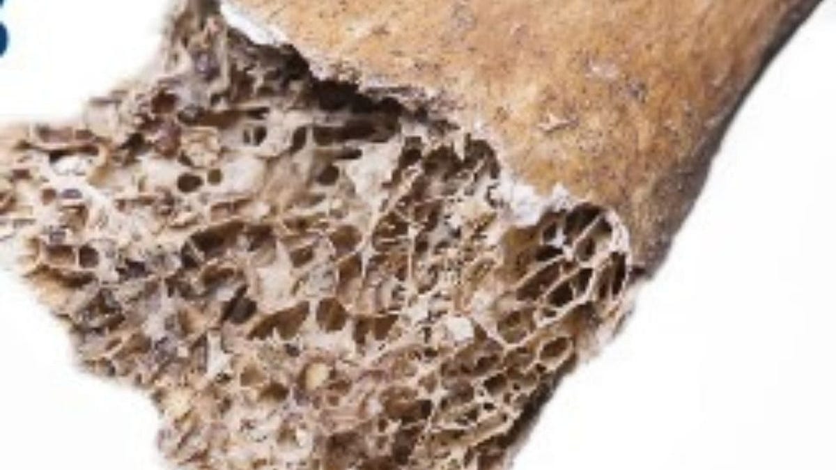“Preserving Skeletal Integrity. As we age, the health of our bones ...