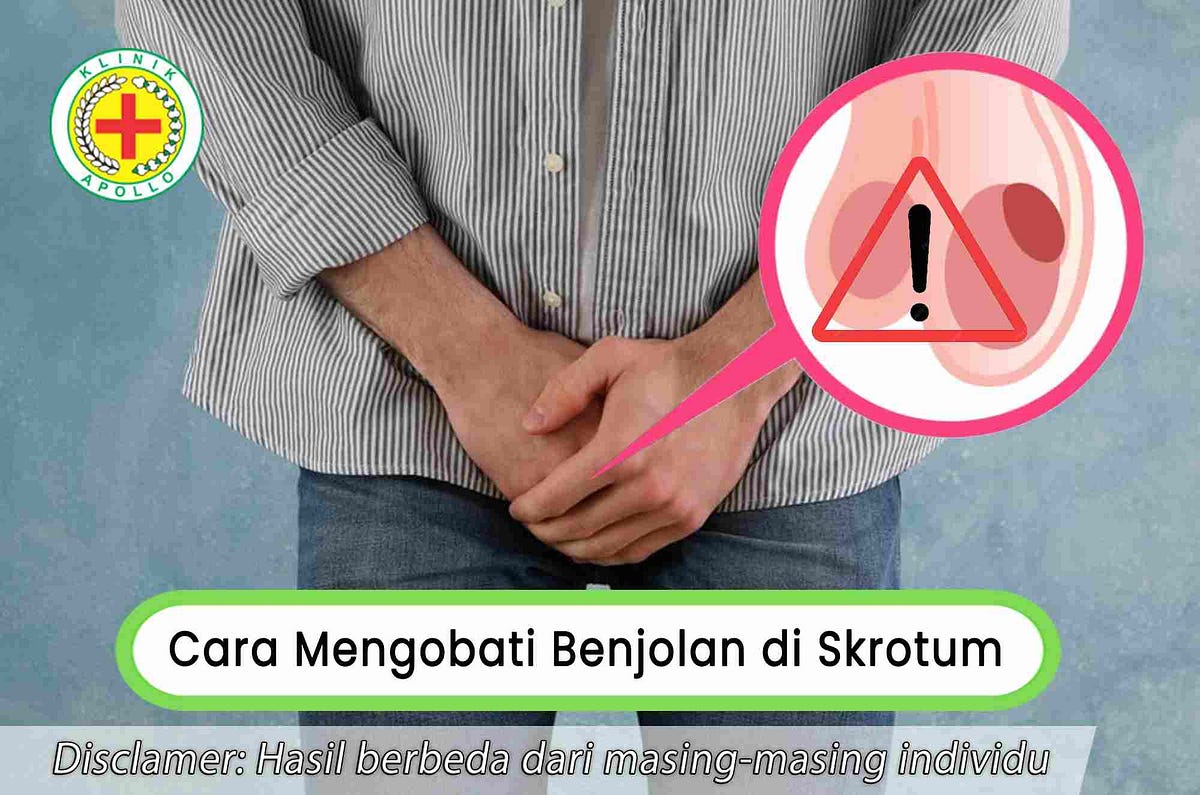 Strategi atau Cara Mengobati Benjolan di Skrotum secara Efektif | by ...